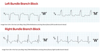 ECG Technical Overview | PDF