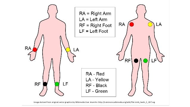 ECG Technical Overview