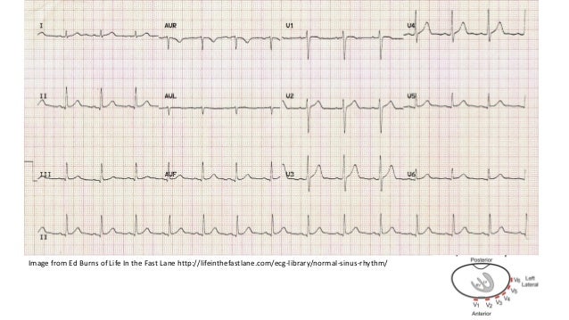 ECG Technical Overview
