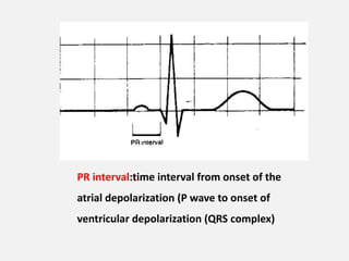 Ecg paramedics | PPTX