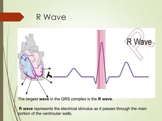 ECG_Part-2__1_.ppt about ecg in veterinary animals | PPT