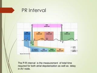 ECG_Part-2__1_.ppt about ecg in veterinary animals | PPT