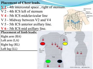 Ecg part i | PPT