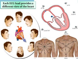 Ecg part i | PPTX