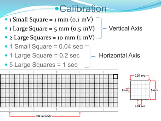Ecg part i | PPTX
