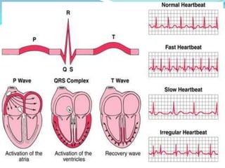 Ecg part i | PPT