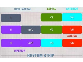 Ecg part i | PPT