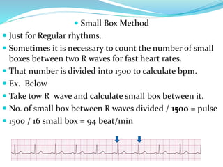 Ecg part i | PPT