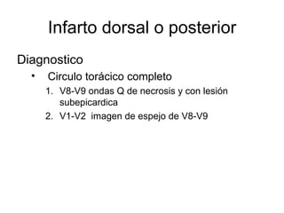 Ecg patologia isquemica | PPT
