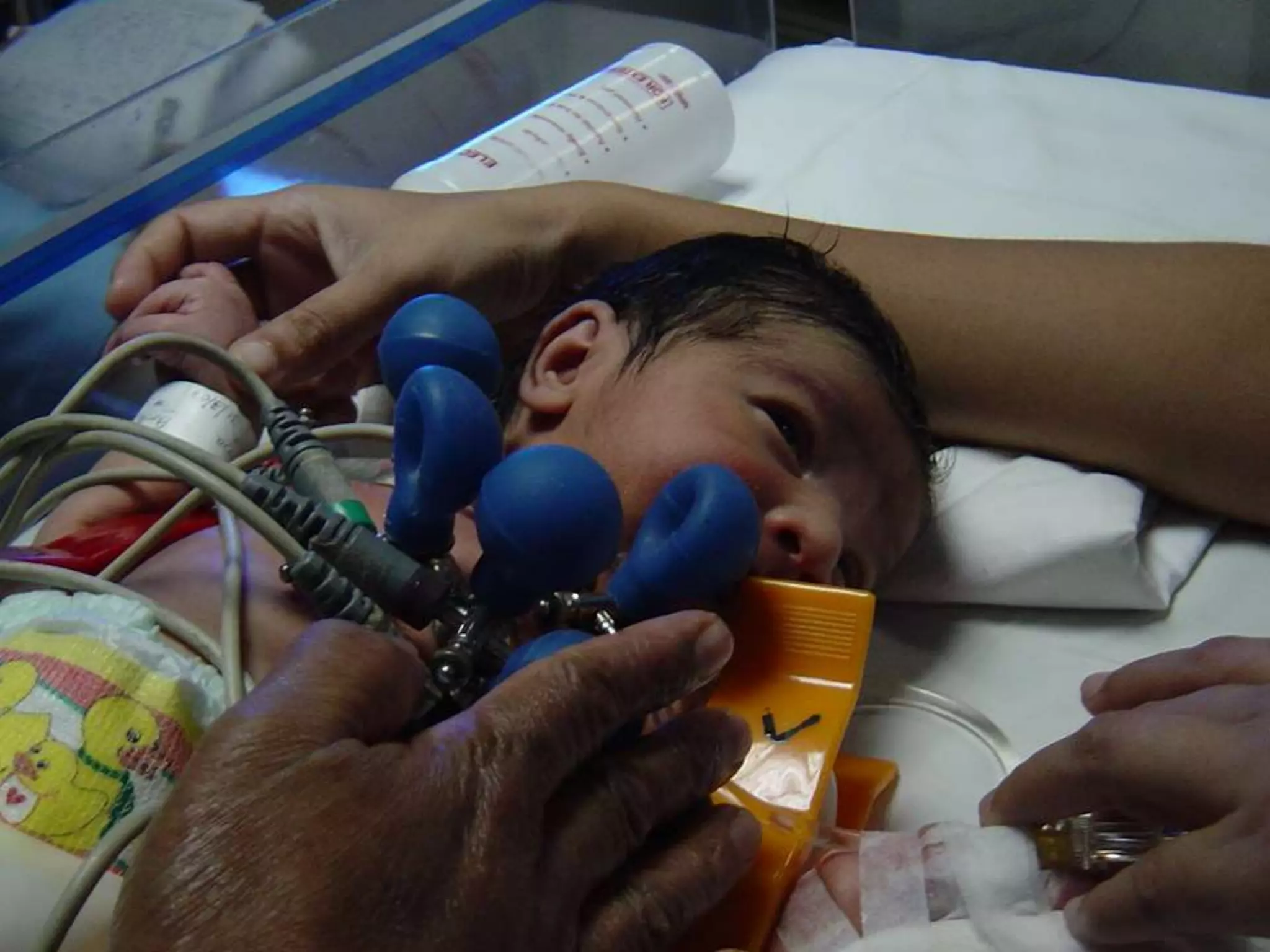Ecg pediatric | PPTX