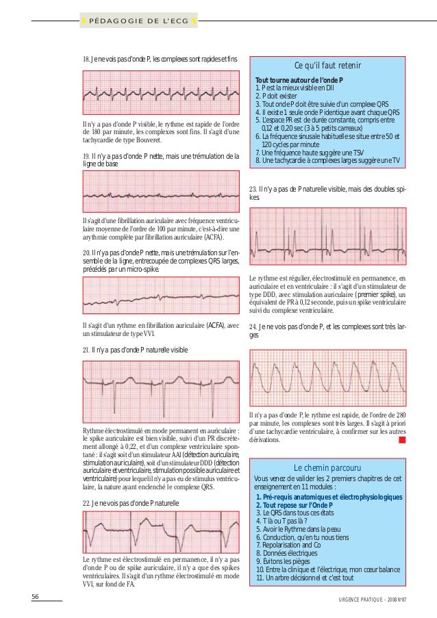Ecg pour les nuls partie 2