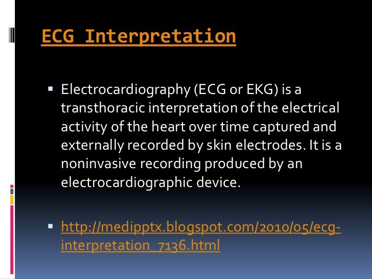 Ecg powerpoint presentations