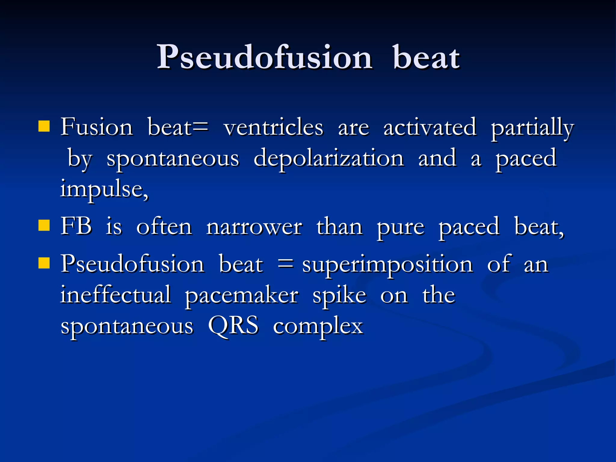 ECG PPI, ASD | PPT