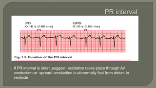 Ecg ppt | PPTX