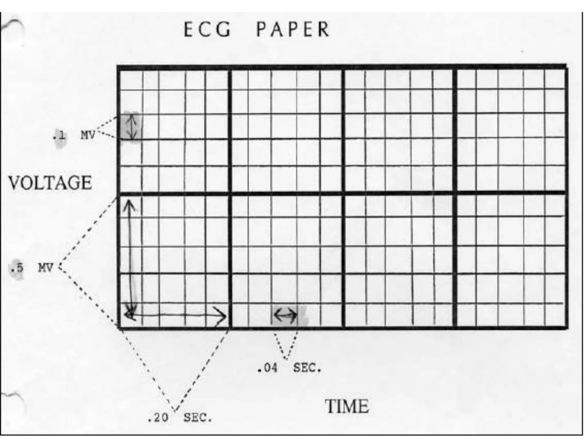 Ecg Ppt Ppt