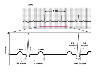 ECG ppt.ppt