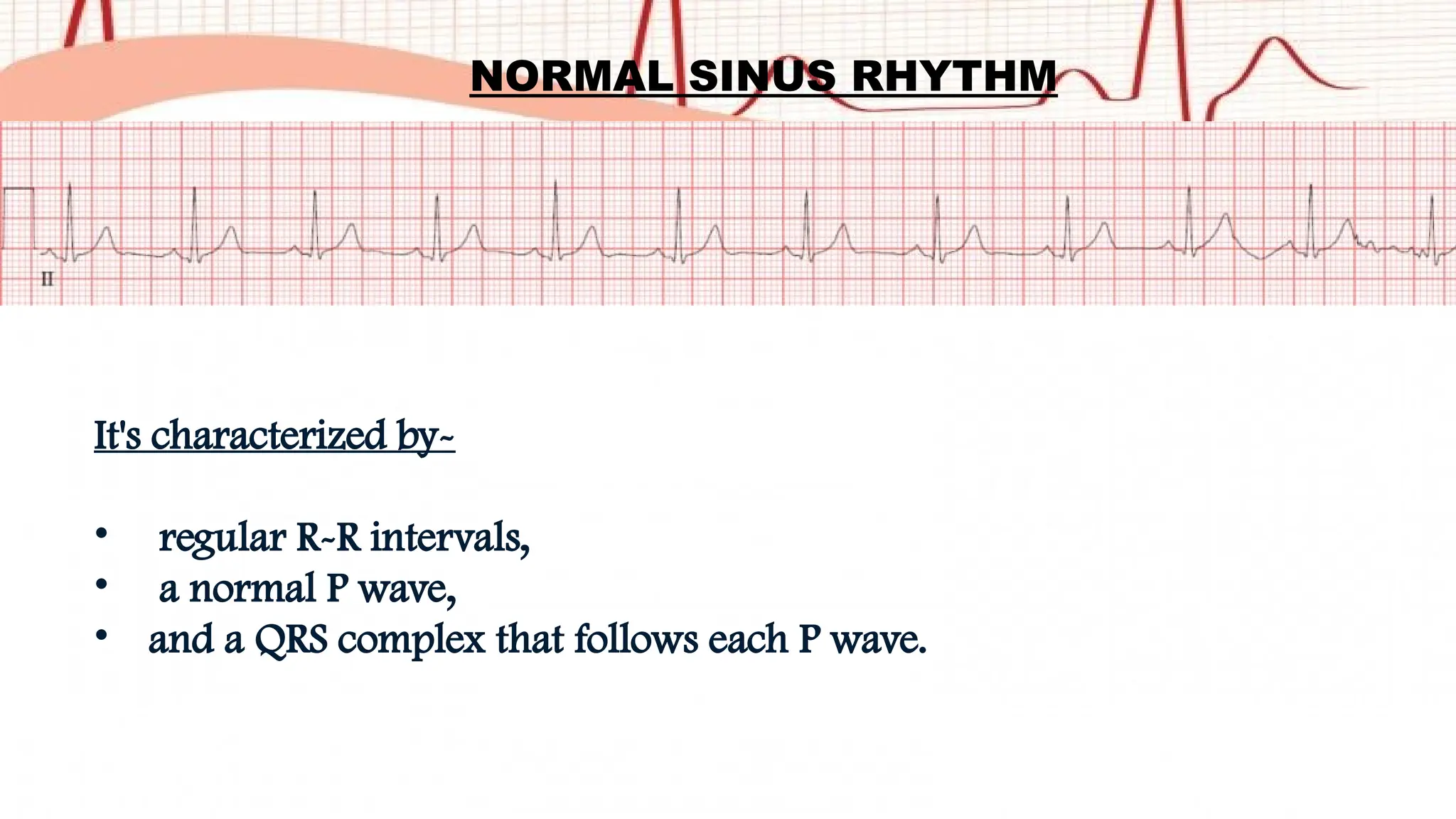 ECG ppt NEW.pptx ECG ppt NEW.pptx ECG ppt NEW.pptx