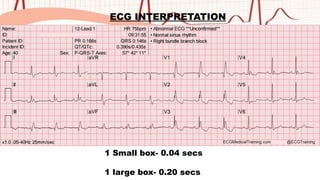 ECG ppt NEW.pptx ECG ppt NEW.pptx ECG ppt NEW.pptx