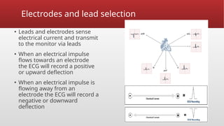 ECG basics an introduction to rhythm recognition | PPTX