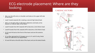 ECG basics an introduction to rhythm recognition | PPTX