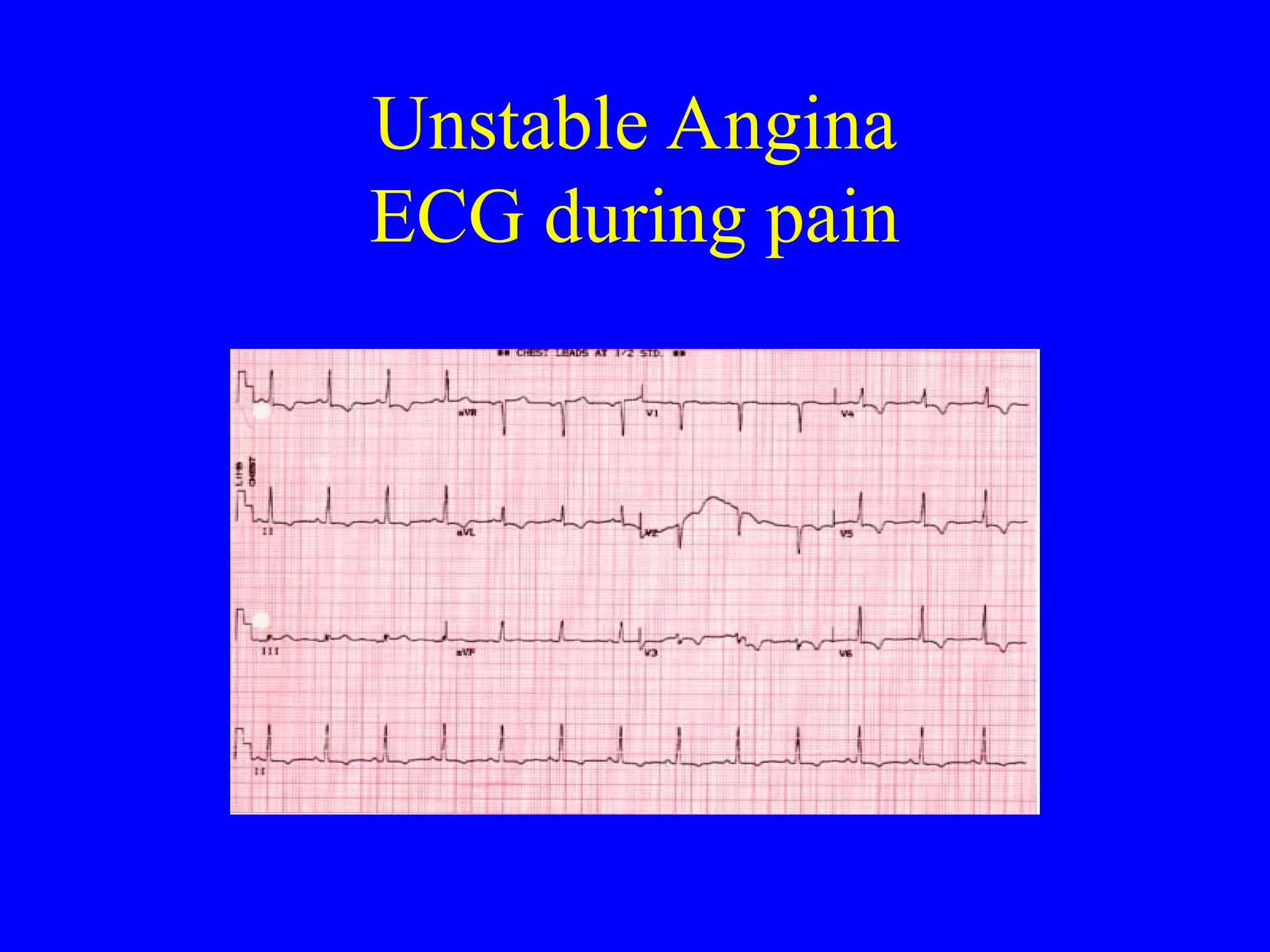 ECG Practicals.ppt for practical purpose | PPT