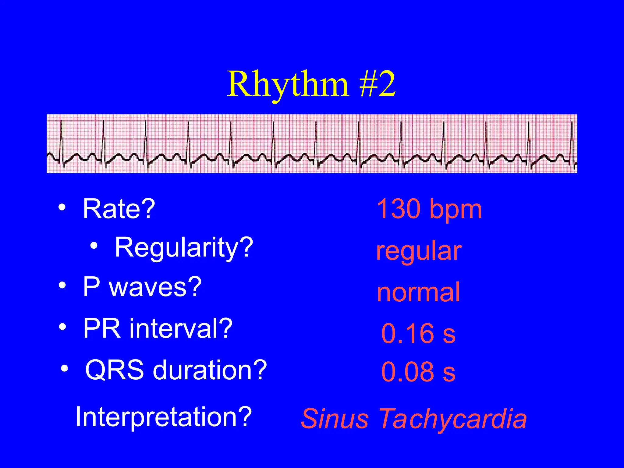 ECG Practicals.ppt for practical purpose | PPT