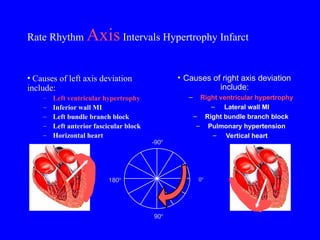 ECG Practicals.ppt for practical purpose | PPT