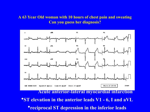ECG Practicals.ppt for practical purpose | PPT