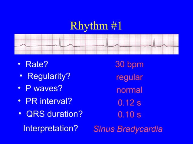 ECG Practicals.ppt for practical purpose | PPT