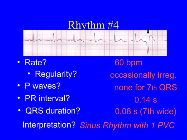 ECG Practicals.ppt for practical purpose | PPT