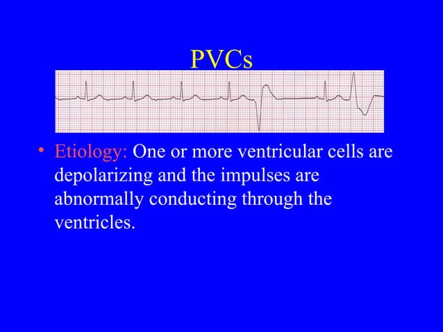 ECG Practicals.ppt for practical purpose | PPT