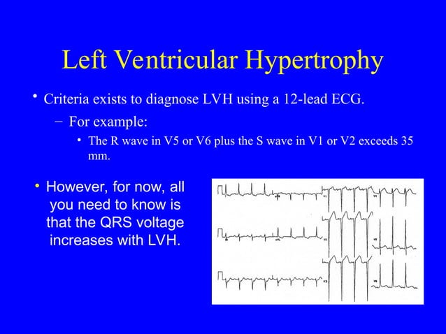 ECG Practicals.ppt for practical purpose | PPT