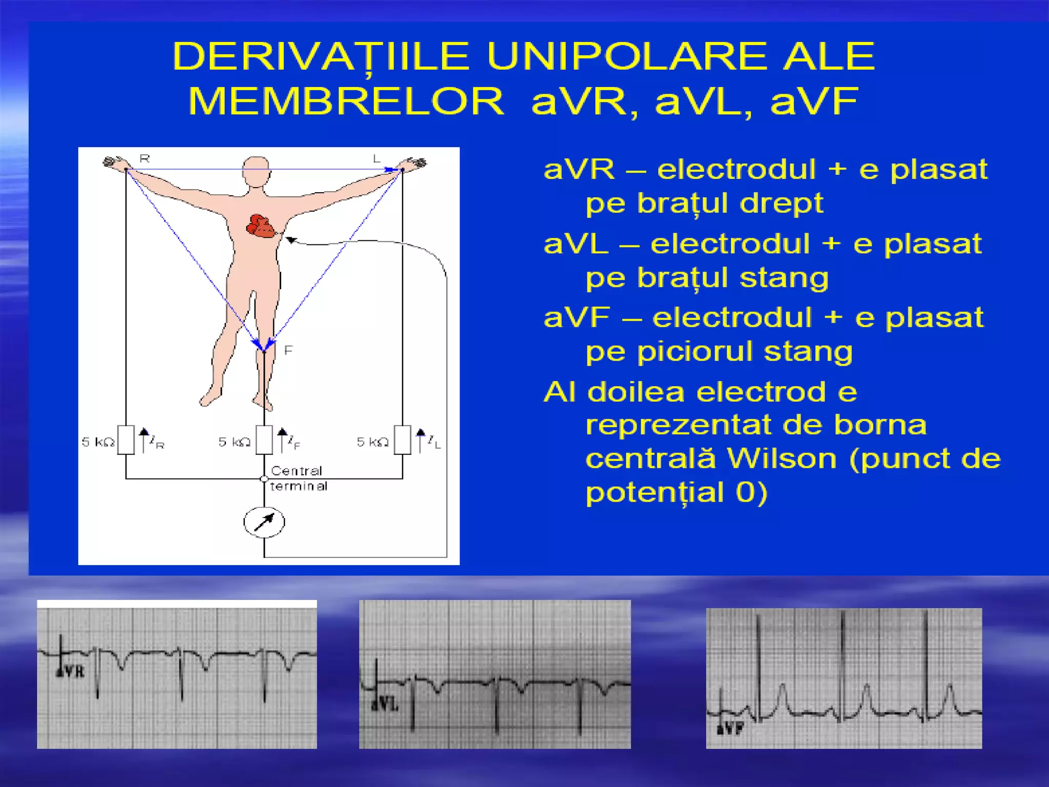 ECG: electrocardiograma | PPT