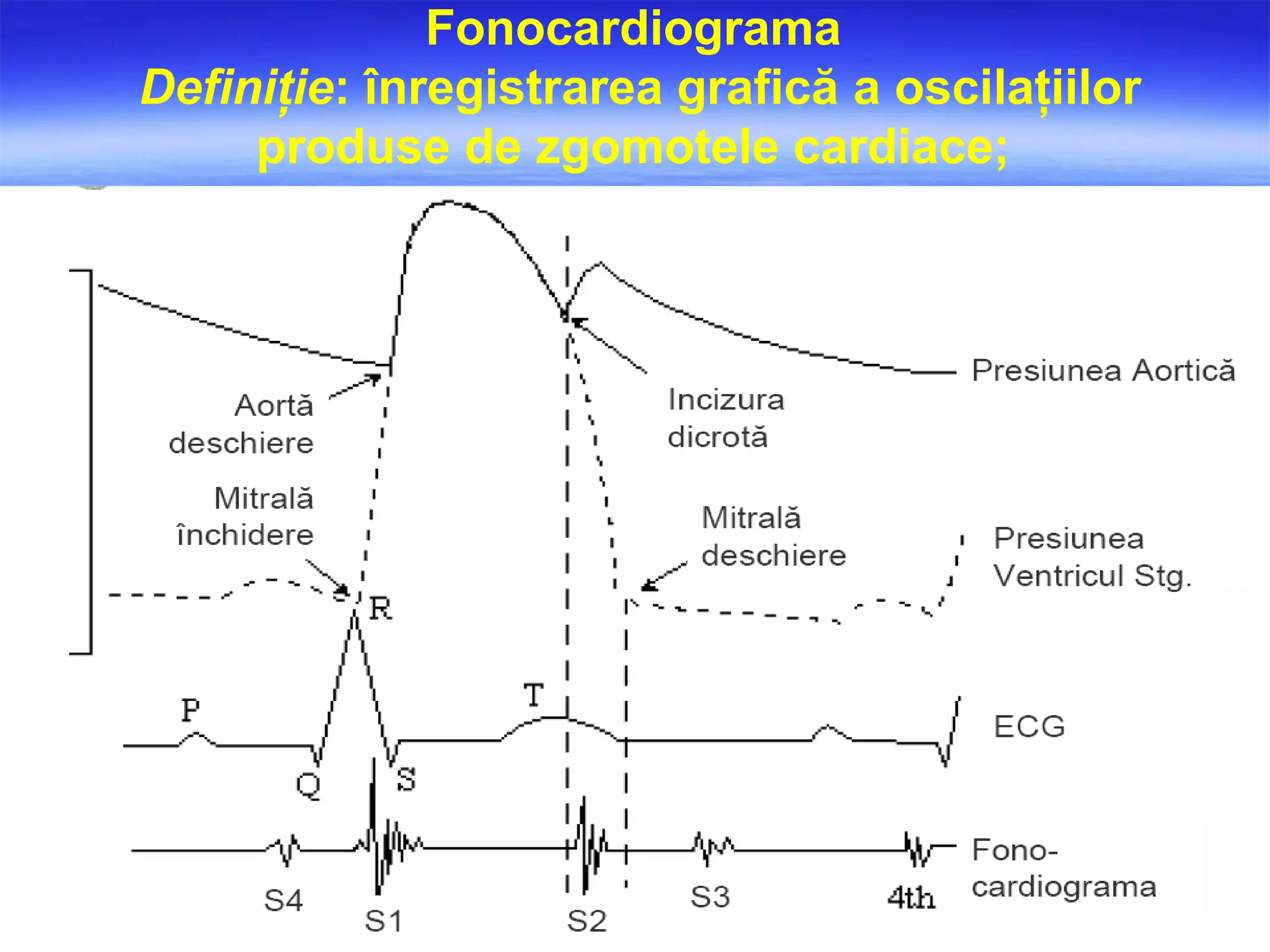 ECG: electrocardiograma | PPT