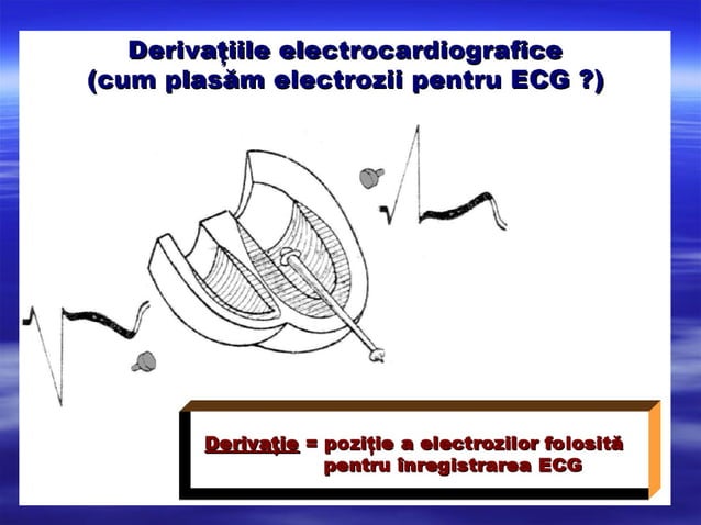 ECG: electrocardiograma | PPT