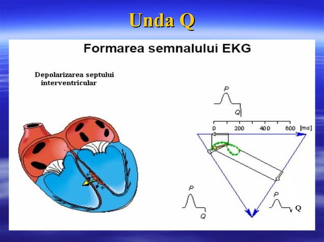 ECG: electrocardiograma | PPT
