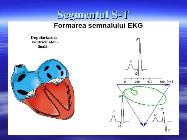 ECG: electrocardiograma | PPT