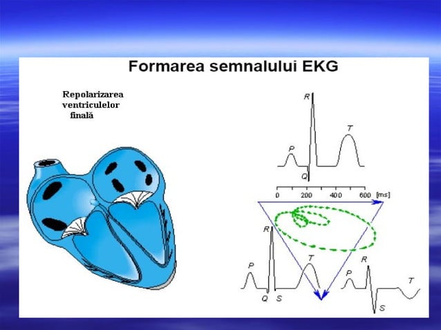ECG: electrocardiograma | PPT