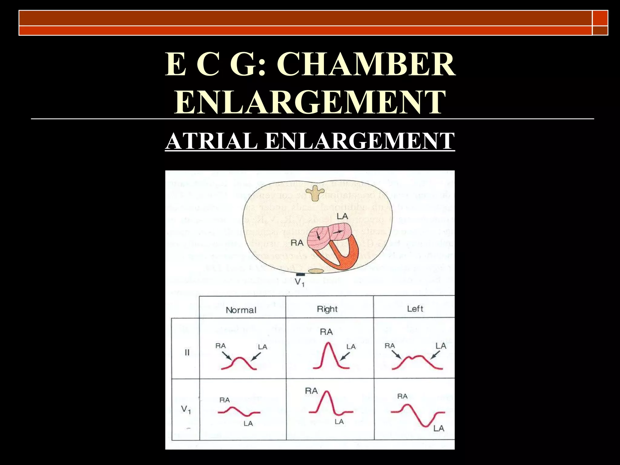 Ecg presentation | PPT