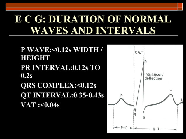 Ecg presentation | PPT
