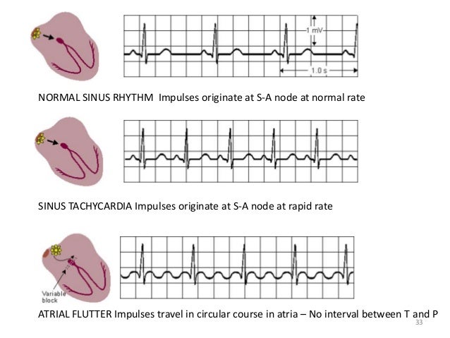 ELECTROCARDIOGRAPHY (ECG)