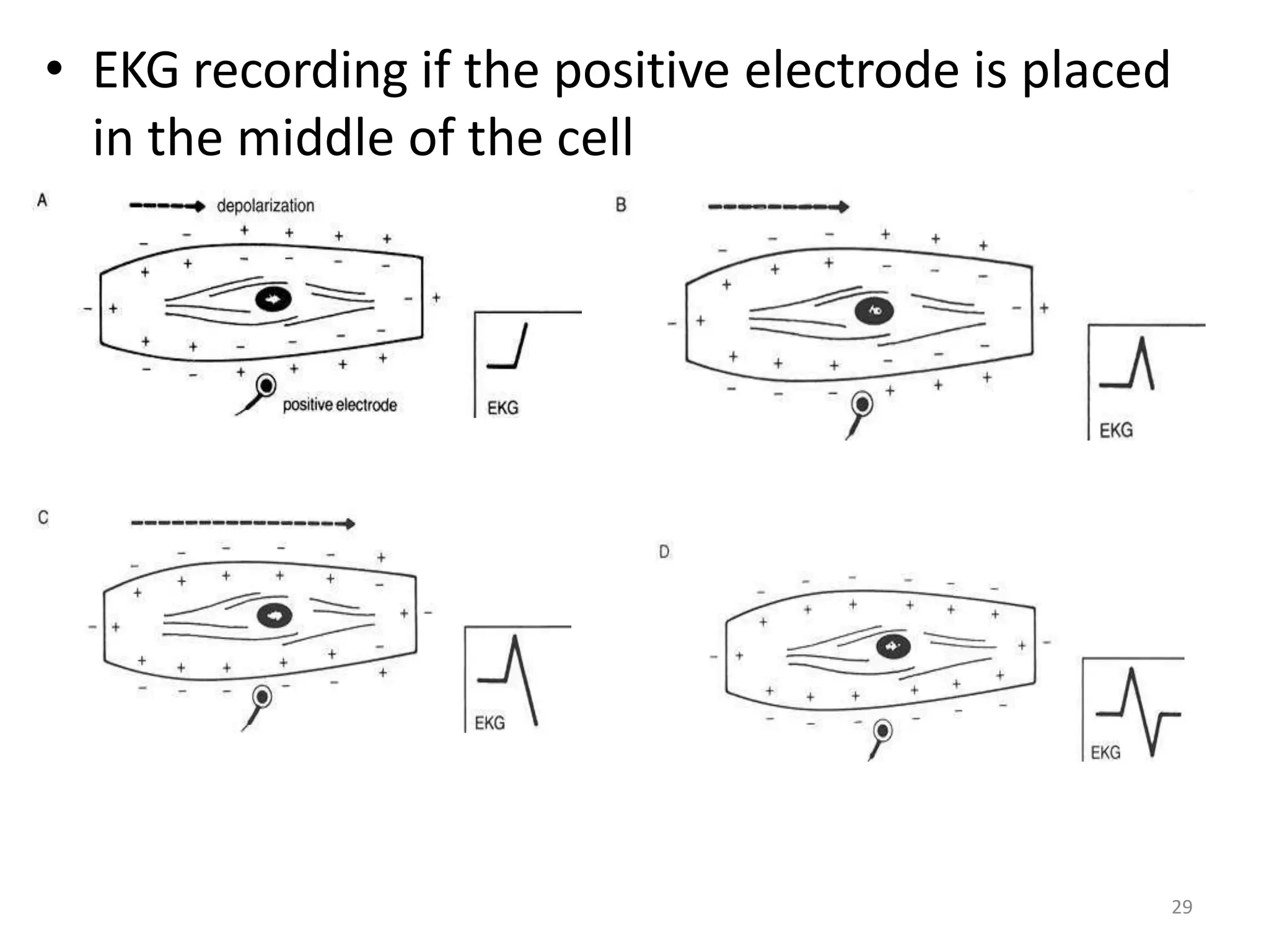 ECG(Electrocardiogram) presentation | PPTX