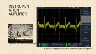 Senior Project Students' Presentation on ECG Monitoring | PPTX