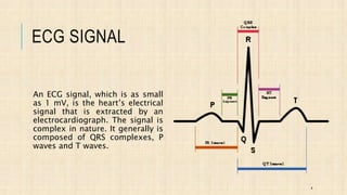 Senior Project Students' Presentation on ECG Monitoring | PPTX