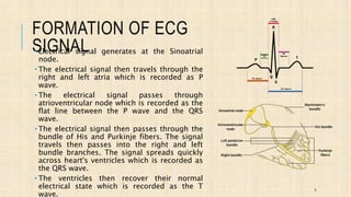 Senior Project Students' Presentation on ECG Monitoring | PPTX