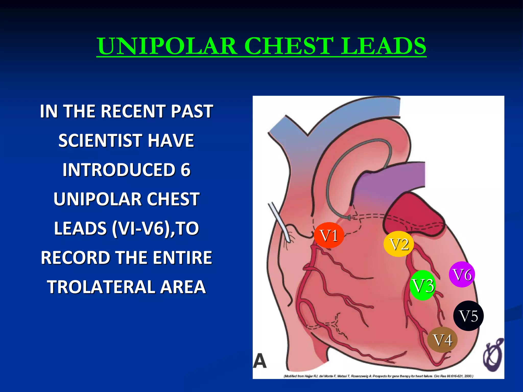 Ecg presentation | PDF