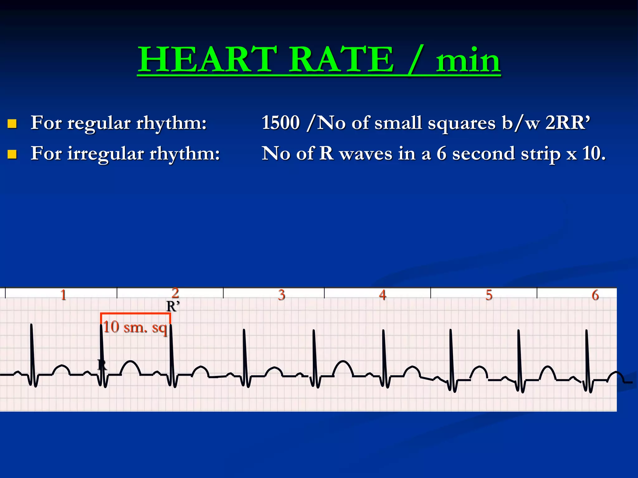 Ecg presentation | PDF