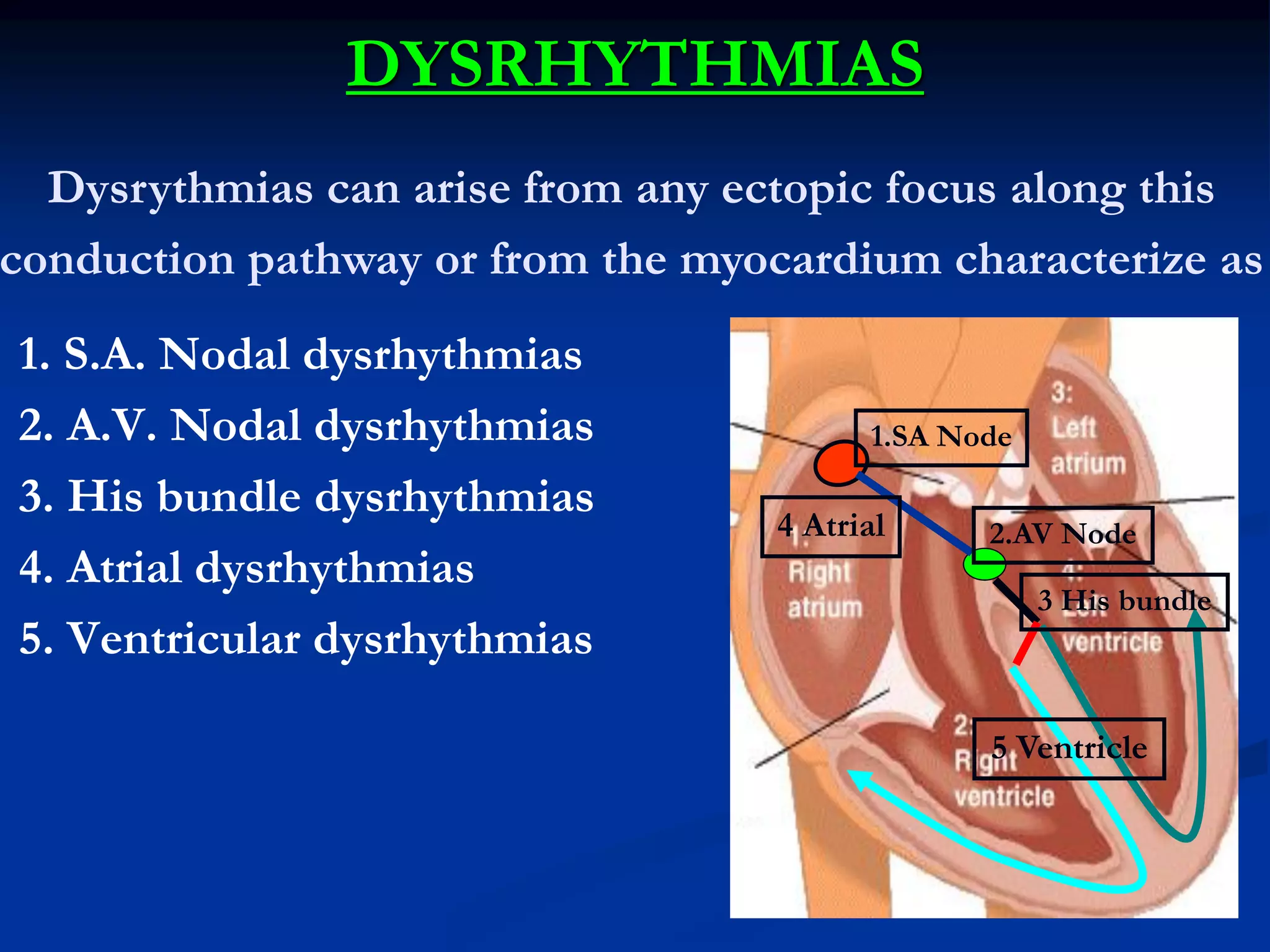 Ecg presentation | PDF