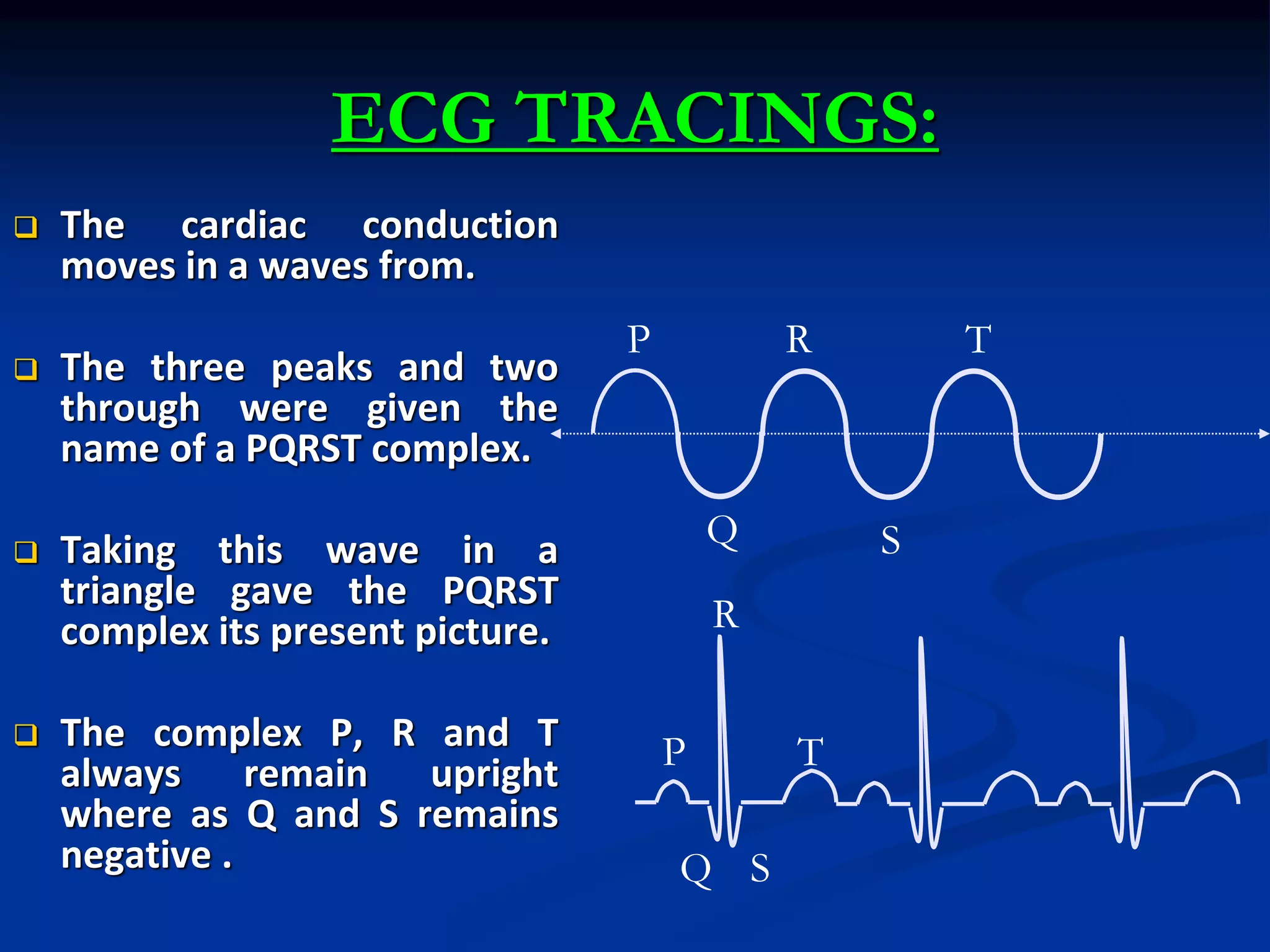 Ecg presentation | PDF