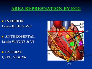 Ecg presentation | PDF